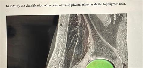 [answered] 6 Identify The Classification Of The Joint At The Epiphyseal