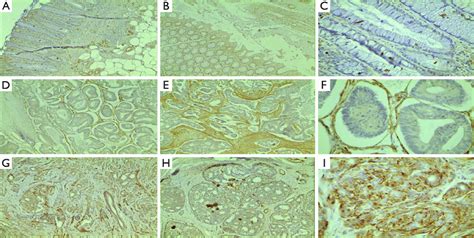 Immunohistochemical Staining Of Foxp3 A B Immunohistochemical Download Scientific Diagram