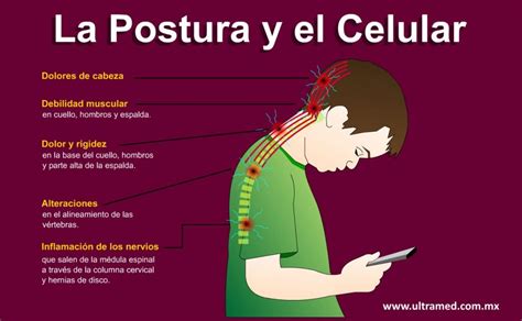 Mejorar La Postura El Manejo Del Dolor 2023