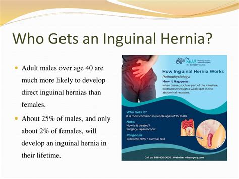Ppt Inguinal Hernia Types Symptoms Diagnosis And Treatments