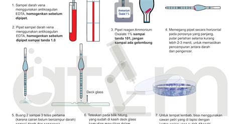 Menghitung Jumlah Sel Trombosit Metode Visual Hemositometer Online