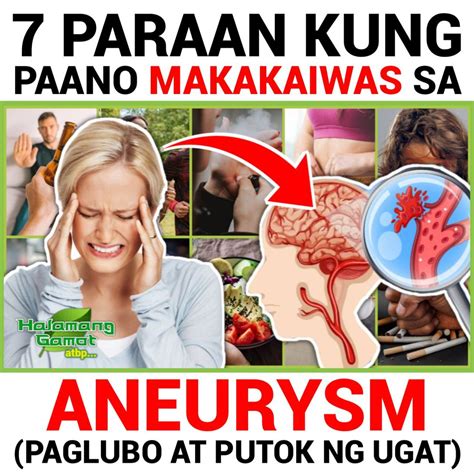 7 Paraan Kung Paano Makakaiwas Sa Aneurysm 7 Paraan Kung Paano