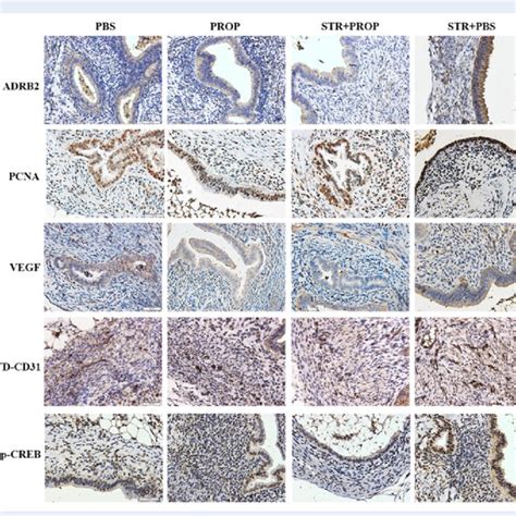 Representative Microphotographs Showing Immunohistochemical Staining Of
