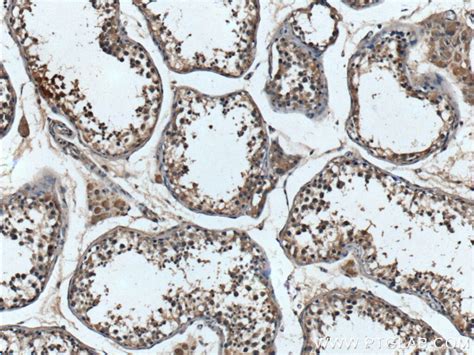 Ddr1 Antibody 10536 1 Ap