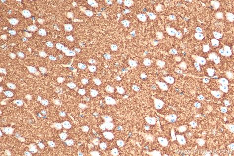 Results For Vglut2 Proteintech Group