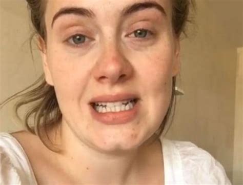 Sick Looking Adele Apologizes To Fans After Cancelling Concert Due To