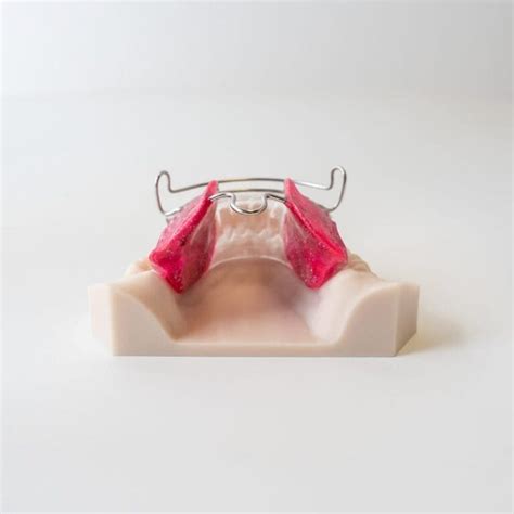 Bionator 1 And 2 Odl Orthodontic Labs