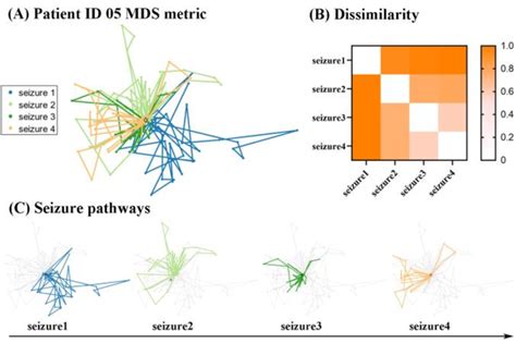 Visualizing And Comparing Seizure Pathways Through Network Space In An