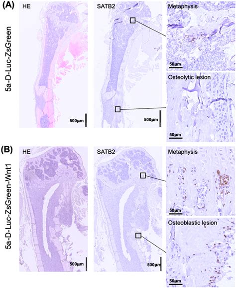 Hematoxylin And Eosin And Satb2‐immunohistological Staining Of Bones In