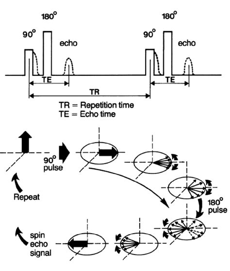 3 Illustration Of A 90º Spin Echo Pulse Sequence Download