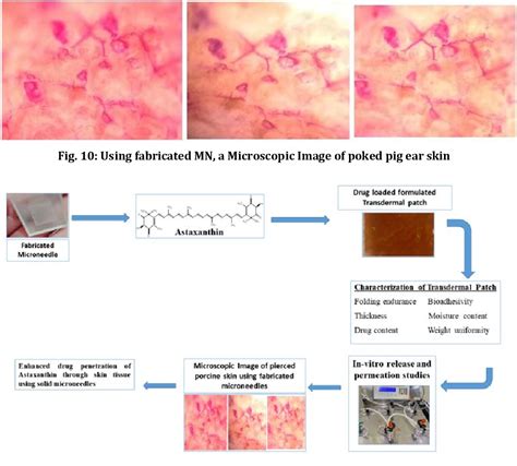 Figure 1 From Evaluation Of Fabricated Solid Microneedles As Smart Approach For Transdermal Drug