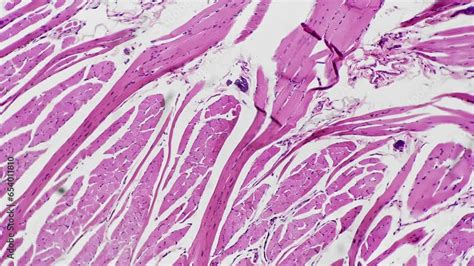 Human Tongue In Longitudinal Section Showing Filiform Papillae Under Microscope 100x On Bright