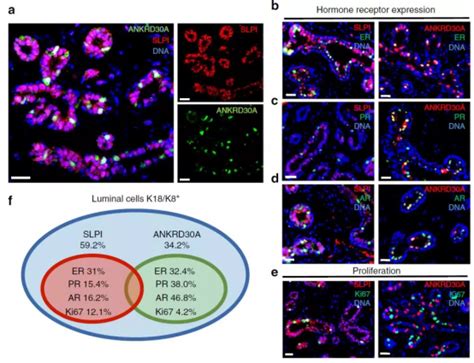 单细胞测序技术分享：乳腺癌细胞多样性 丁香园