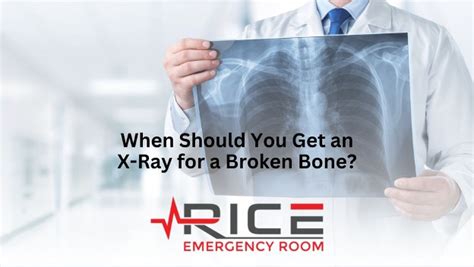 X Ray Broken Ribs Broken Ribs Treatment Expert Thoracic Surgery For