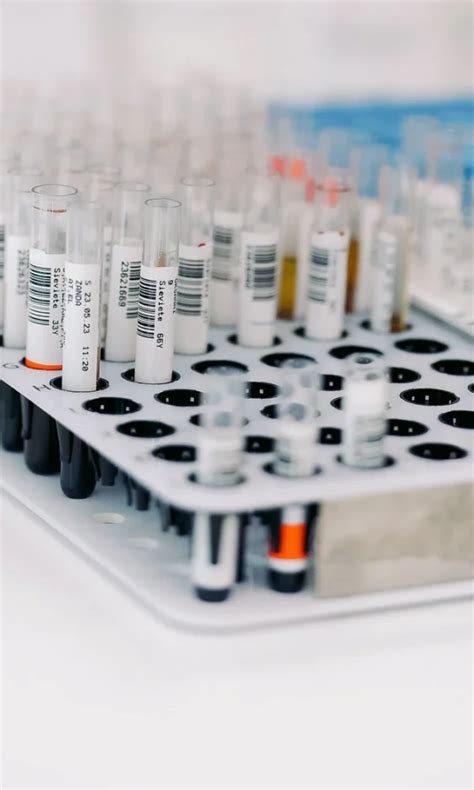 What Is Lab Automation Novaticlab