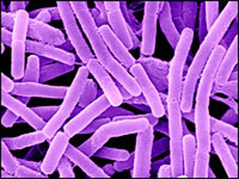 Punnetts Square Anthrax Rna Coat Is Key To Diseases Succsess