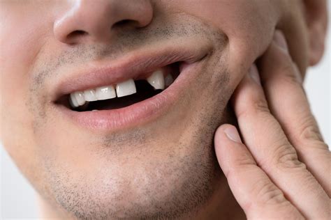 Causes Of A Loose Tooth