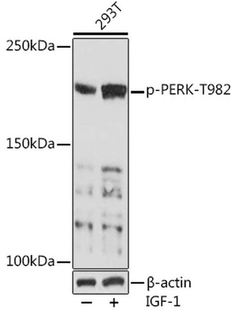 Phospho Perk Thr982 Polyclonal Antibody Pa5 121311