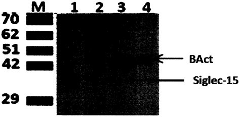 Preparation And Application Of Mouse Monoclonal Antibody Against Human