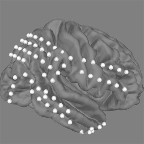 Working With Ecog Data — Mne 131 Documentation