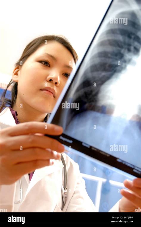 MODEL RELEASED Doctor Studying A Chest X Ray Stock Photo Alamy