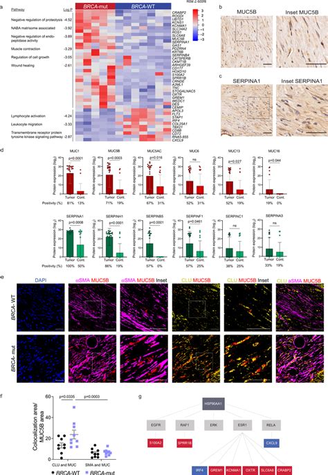 The Transcriptional Profile Of Brca Mut Stroma Is Different Than That