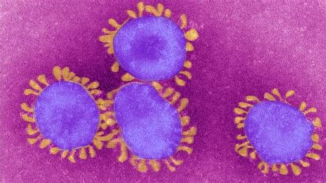 10 Gráficos Para Entender A Situação Atual Do Brasil Na Pandemia De