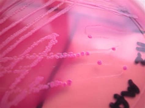 Enterococcus Faecalis Macconkey Agar