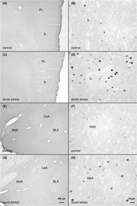 photomicrographs of c fos immunoreactivity in the mpfc a d and the