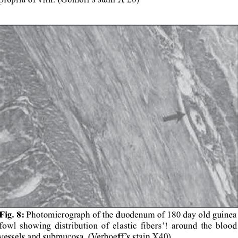 Transmission Electron Micrograph Duodenum Surface Epithelium Showing Download Scientific