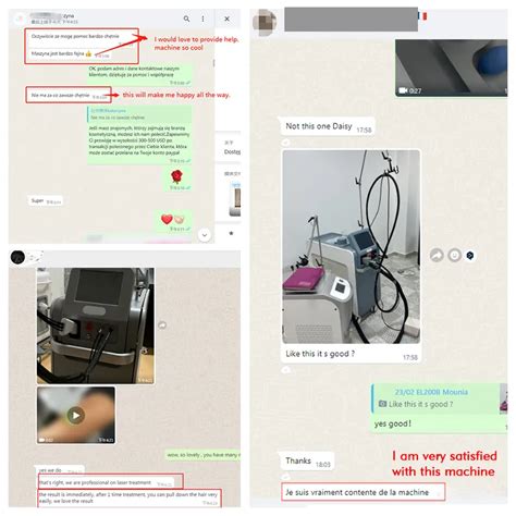 Dual Wave Laser Hair Removal Machine Long Pulse 755nm And 1064nm