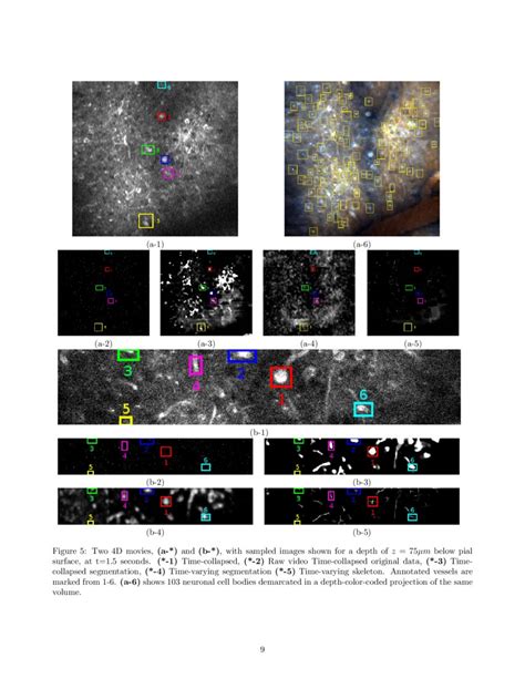 Microvascular Dynamics From 4d Microscopy Using Temporal Segmentation
