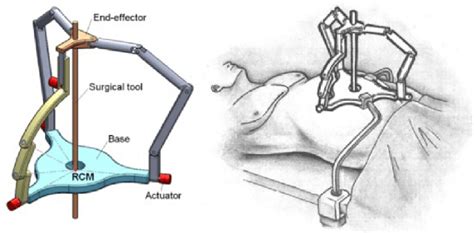 Fully Decoupled 4 Dof Rcm Parallel Manipulator Download Scientific
