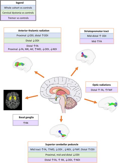 Of Key Findings Fa Fractional Anisotropy Md Mean Diffusivity Mk Mean