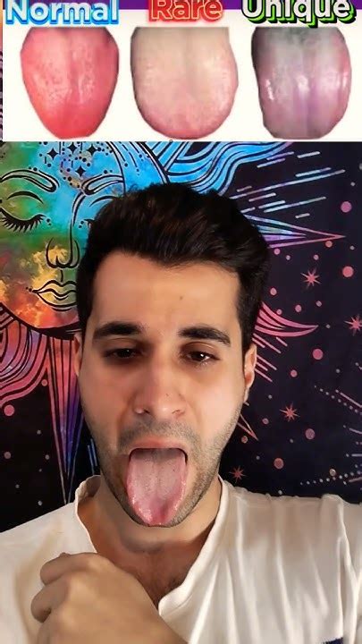 Trend Video Shorts Challenge Tiktok Viralvideo شفا اغاني فقط