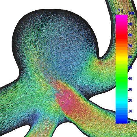 A Velocity Field At The Systolic Peak B Streamlines Colored