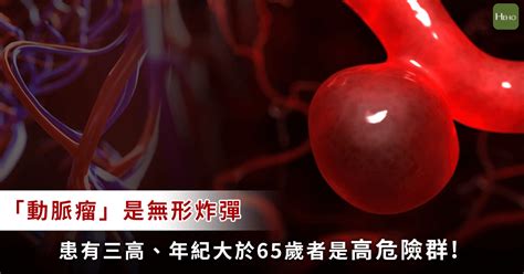 「心臟掉到肚子」原來是致命動脈瘤！醫提醒：腦、胸、腹部都可能發生 Heho健康