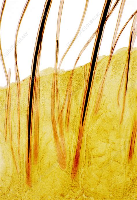 Hairs On The Scalp Light Micrograph Stock Image P7200299 Science Photo Library