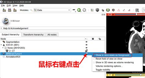在Data模块中如何将序列重叠观看 问题求助 DSlicer中文论坛