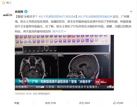 图文详情