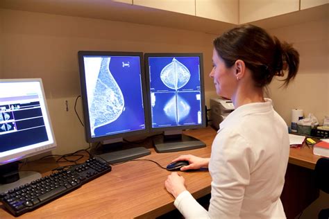 Do The New Uspstf Recommendations Go Far Enough On Mammography Screening
