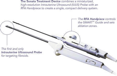 The Sonata System Gynesonics Us
