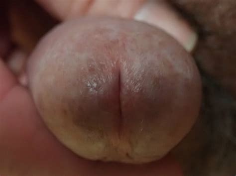 My Penis Up Close 13 Pics Xhamster