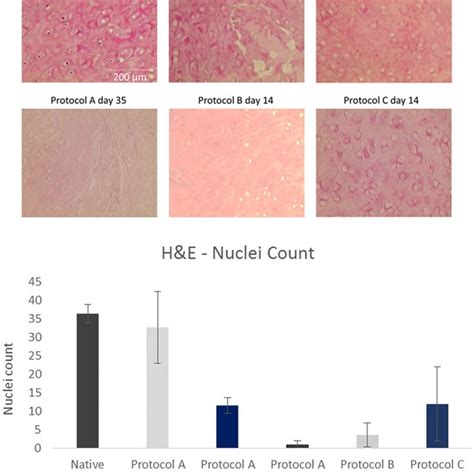 Hande Stained Cartilage Sections Demonstrating Decellularization Of Download Scientific Diagram