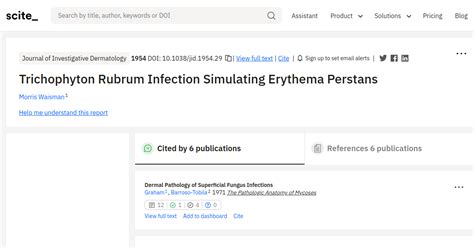 Trichophyton Rubrum Infection Simulating Erythema Perstans [scite Report]