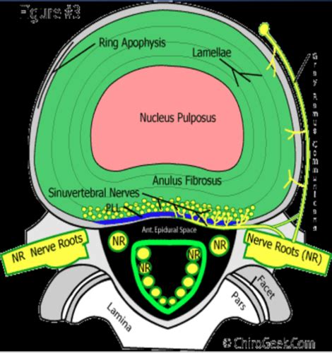 Imaging Flashcards Quizlet