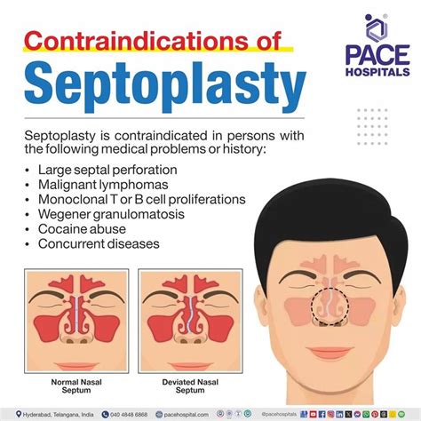 Best Septoplasty Surgery In Hyderabad Cost And Benefits