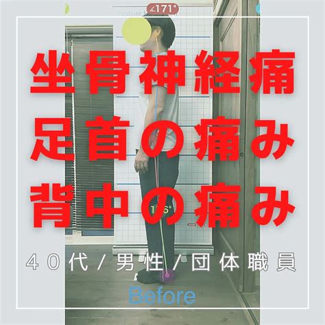 【富里 整体】坐骨神経痛、足首の痛み、背中の痛み 他40代 ブログ 富里で整体ならグッドカイロプラクティック