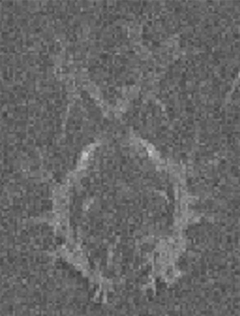 Denoising Micsi