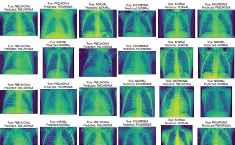 A Machine Learning Based Method For COVID And Pneumonia Detection Biomedical Engineering